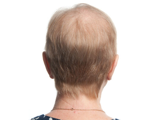 In Depth - Cyberhair & V-Hair New Technology For Wigs | Daniel Galvin